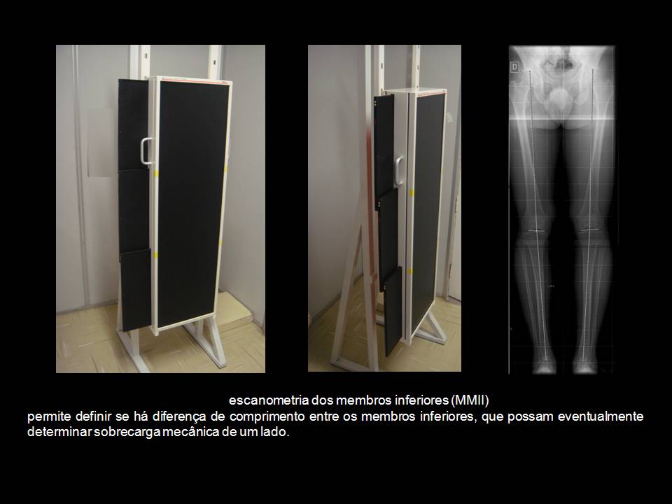 radiografia